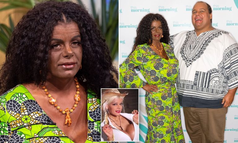 White German Model, Martina Big,Who Took Injections To Change Her Skin ...